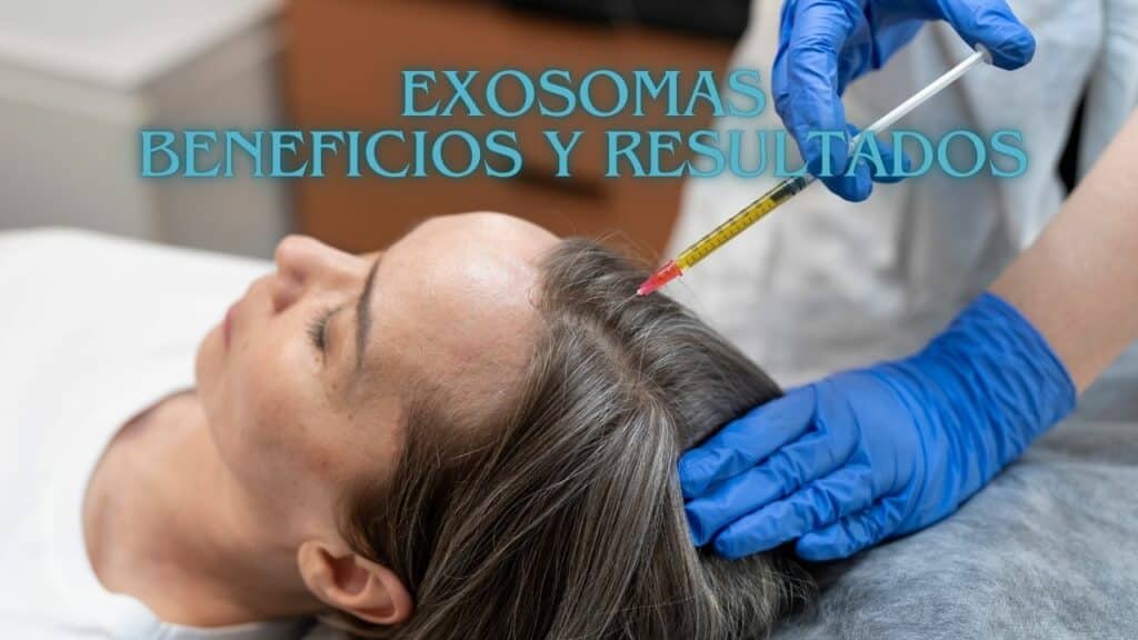 Terapias Capilares Avanzadas con Exosomas Beneficios y Resultados - DHI ...